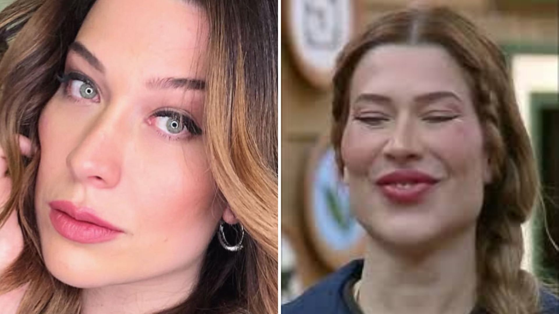 O que aconteceu com o rosto de Renata Muller? Especialista analisa ...